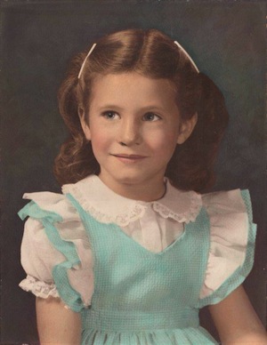 Coping with Alopecia Areata: Thea's Story